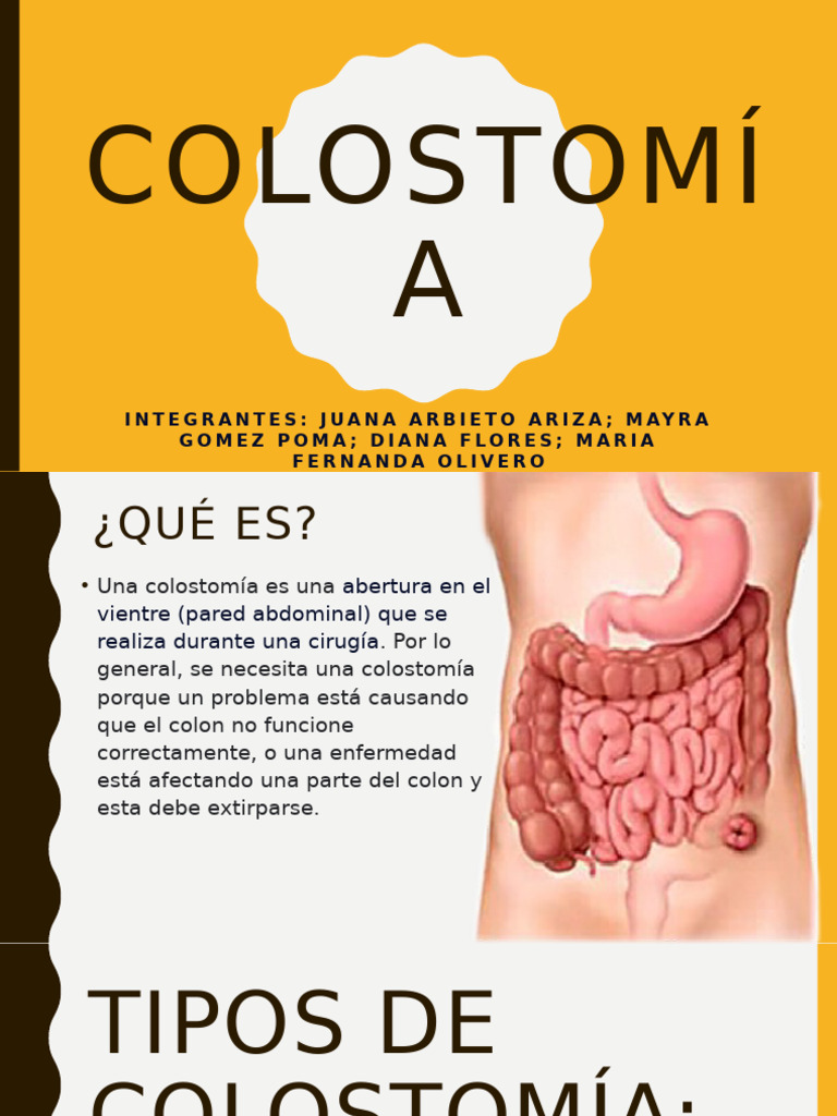 Tipos y cuidados de colostomías | PDF | Intestino grueso | Cirugía