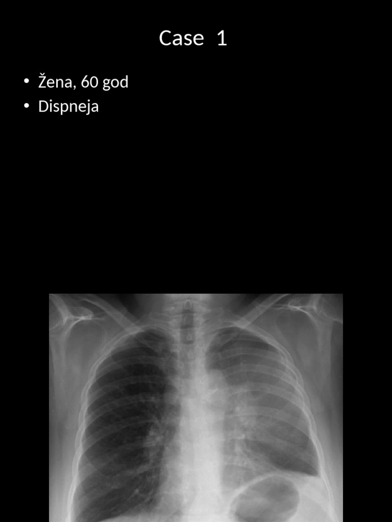 Toraks akutna vjezbe | PDF