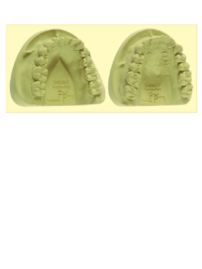 Bredent Modele | PDF