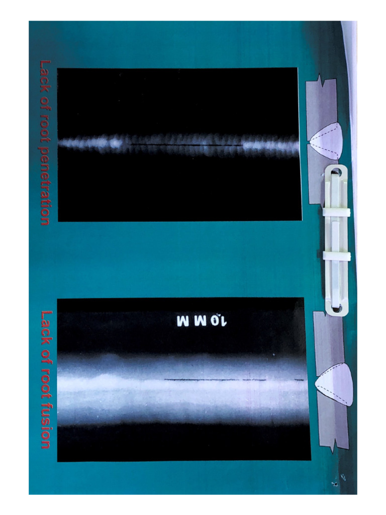 Weld RT Interpretation | PDF