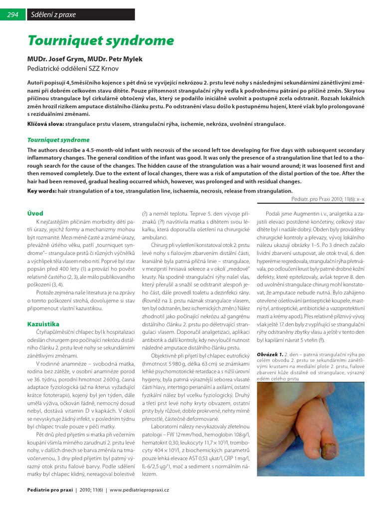 c07 Tourniqute Syndrom | PDF
