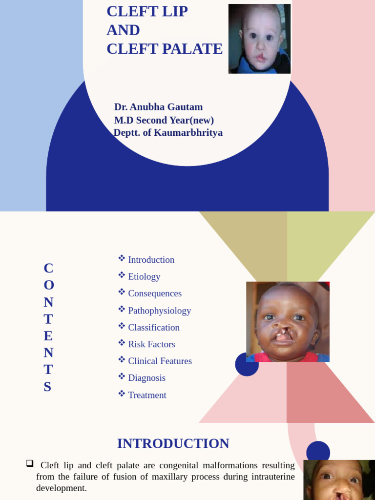 Cleft Lip and Cleft Palate | PDF | Human Nose | Medical Specialties