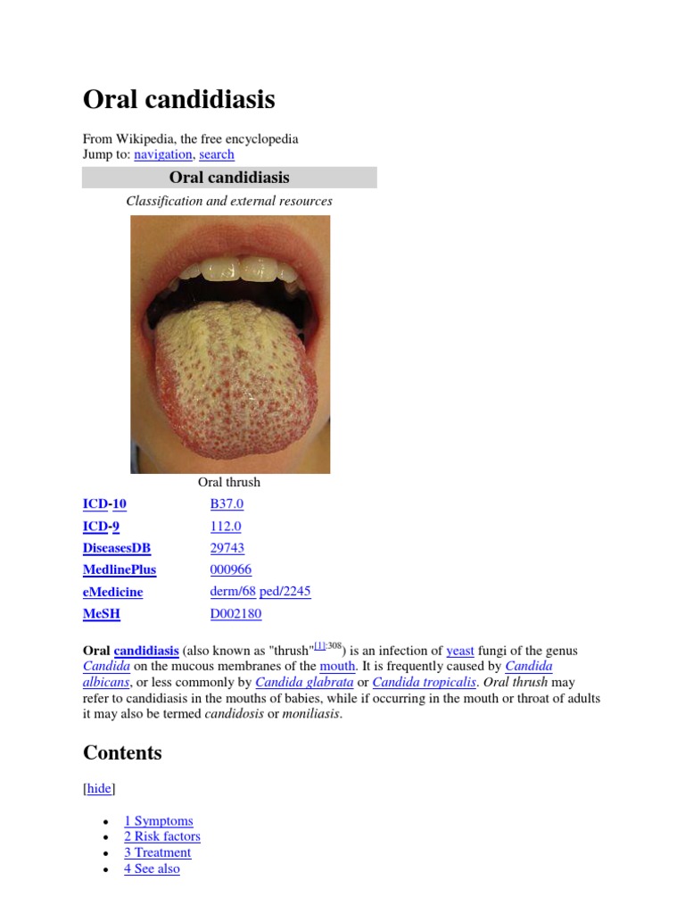Oral Candidiasis | PDF | Candidiasis | Cutaneous Conditions
