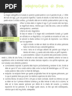 Proyecciones Rx de Tórax: PA y AP | PDF | Tórax (anatomía humana ...