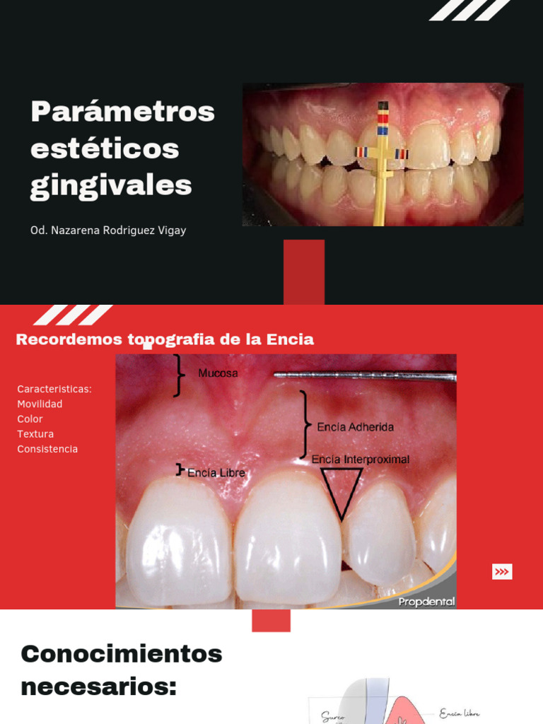 Parámetros Estéticos Gingivales en Odontología | PDF