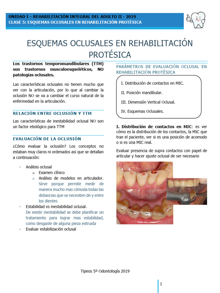 Esquemas Oclusales en Rehabilitación Protésica | PDF | Odontología ...