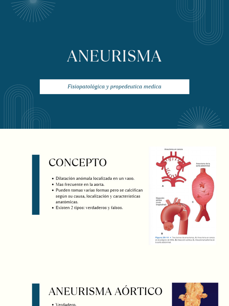 Aneurisma PDF | PDF