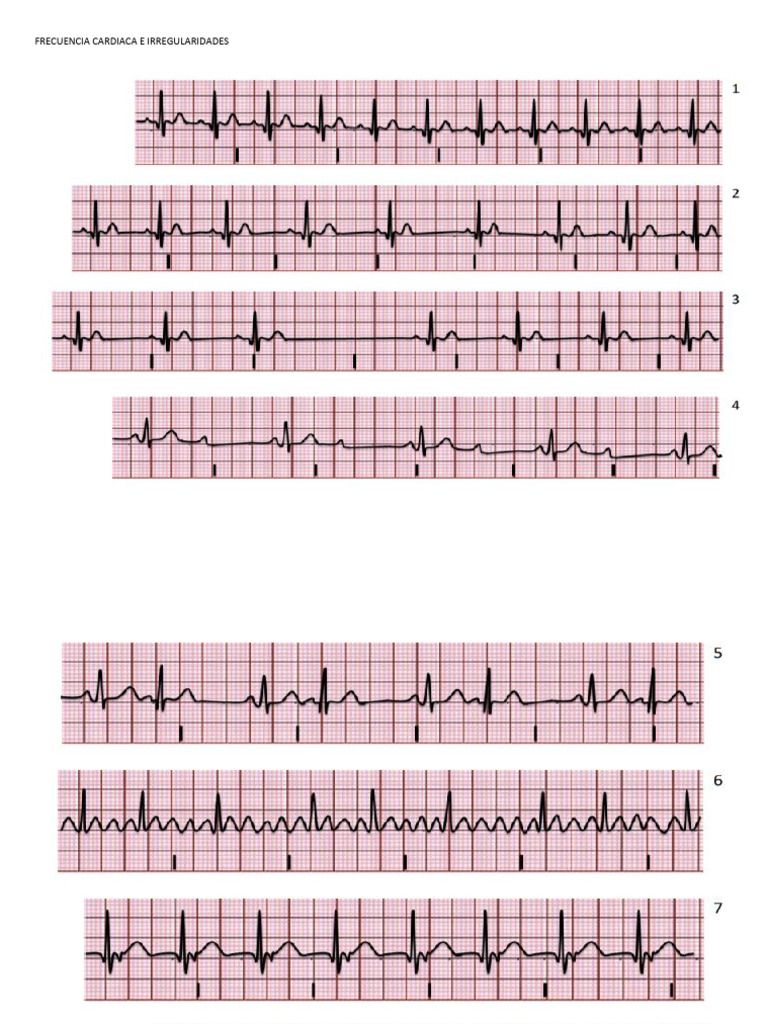 Frecuencia Cardiaca e Irregularidades | PDF