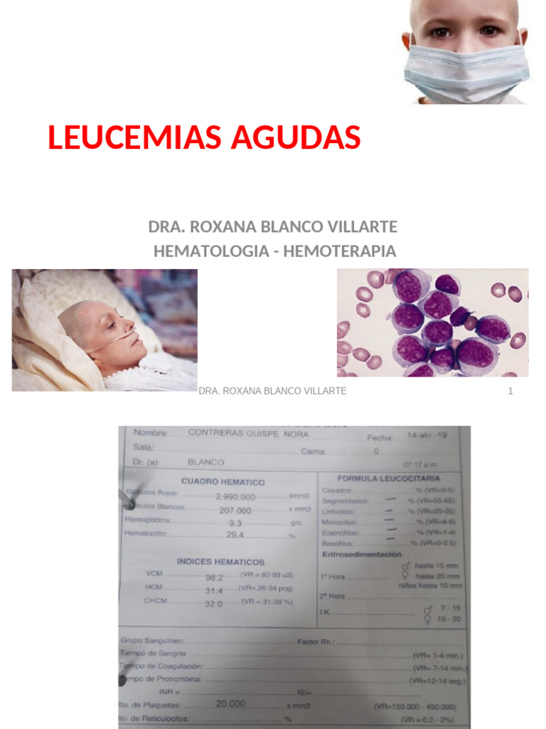 Cutis Leucémico en Leucemias Agudas | PDF | Leucemia | Sangre