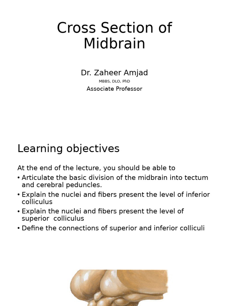 Cross Section of Mid-Brain | PDF | Cerebellum | Neuroanatomy