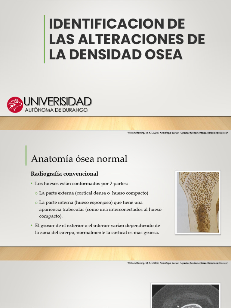 Alteraciones de la Densidad Ósea en Radiología | PDF | Hueso | Radiología
