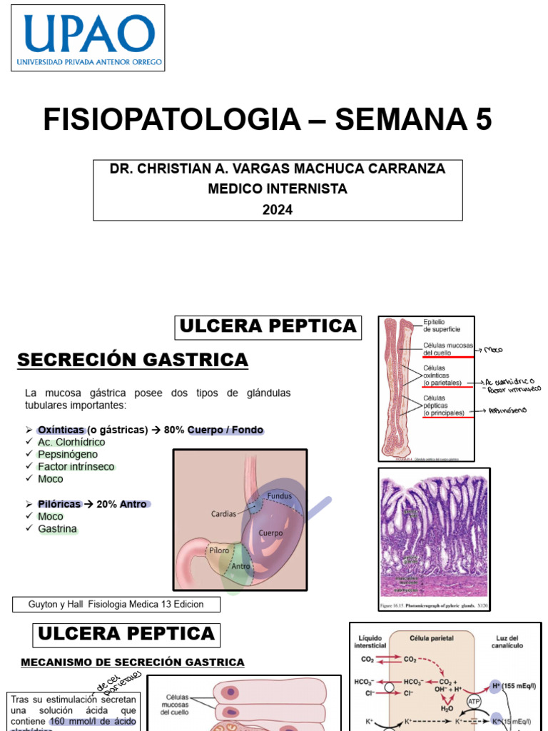 5 - Ulcera Peptica - Hda - Eda - Colon Irritable | PDF | Estómago | Órgano (anatomía)