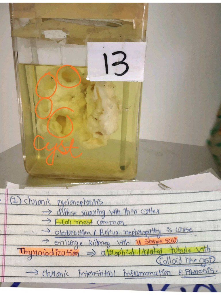 Patho Specimen Gross (SS) | PDF