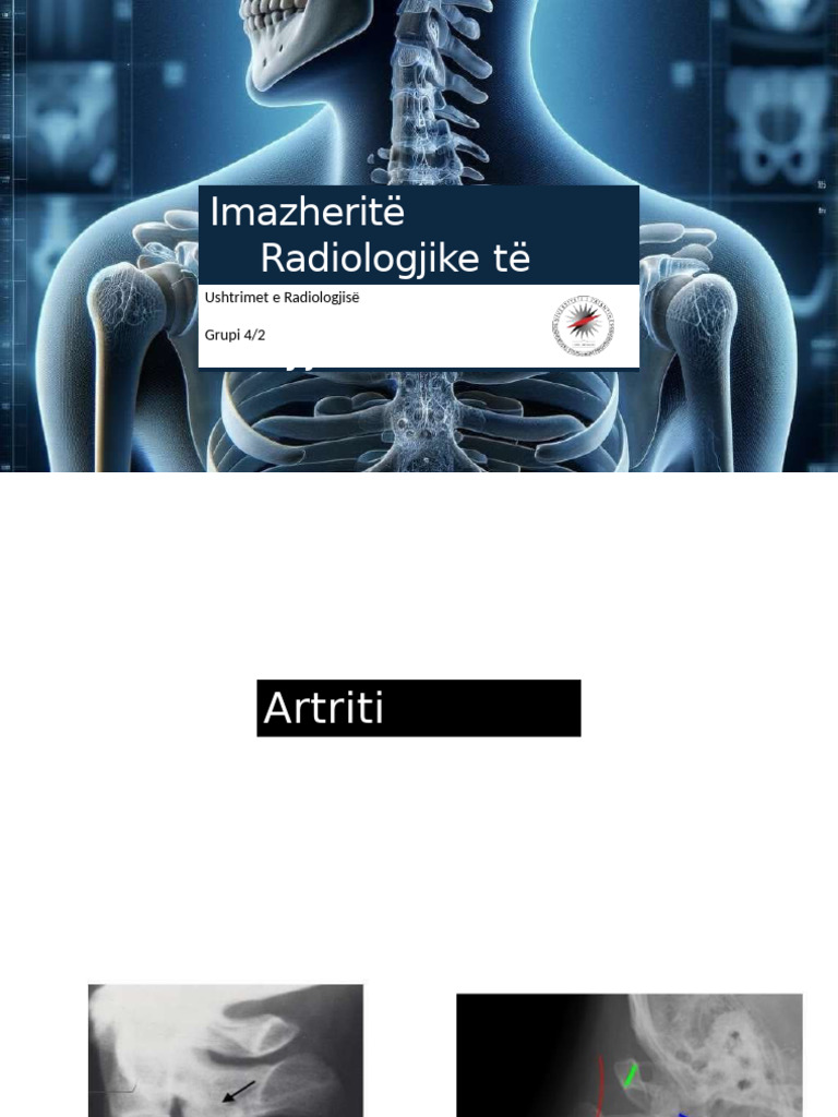 Radiologji Grupi 4:II | PDF