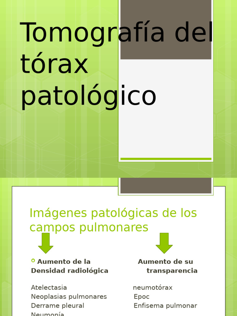 Tomografía Torácica: Signos Patológicos | PDF | Pulmón | Neumonía