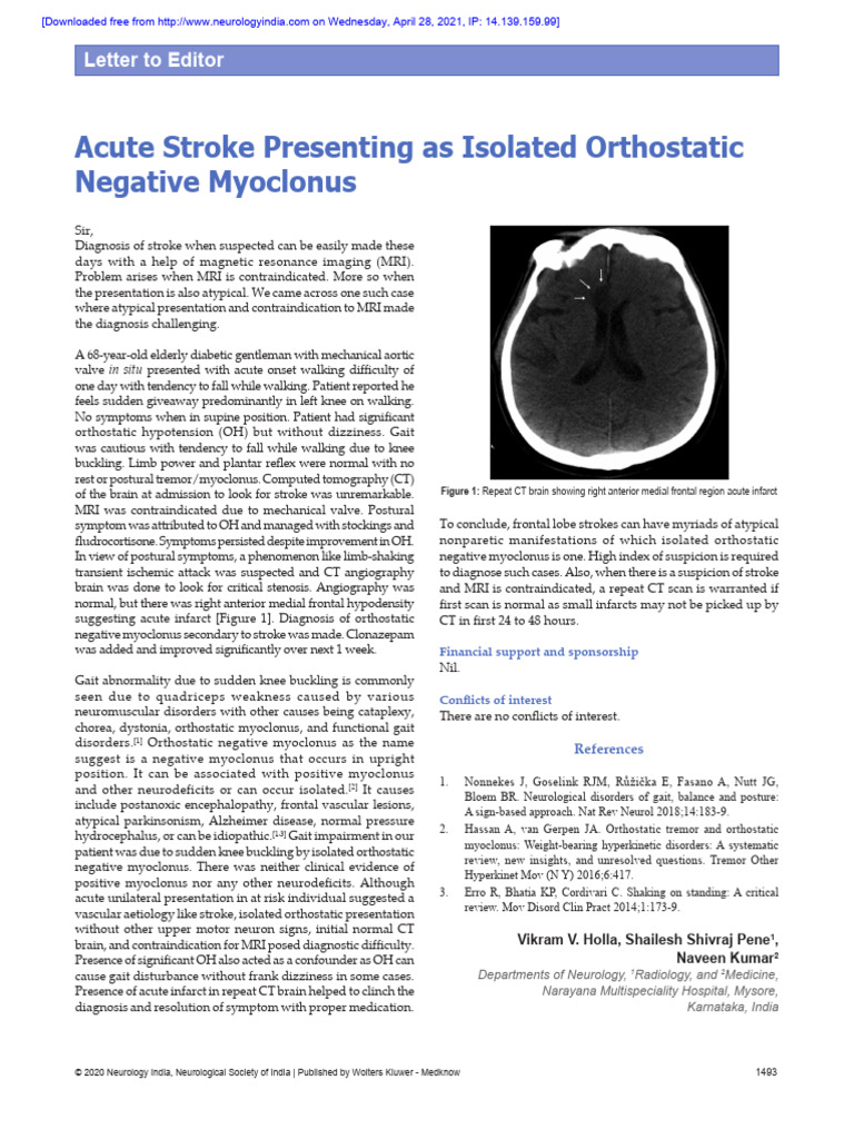 Acute Stroke Presenting As Isolated Orthostatic Negative Myoclonus - 1 ...