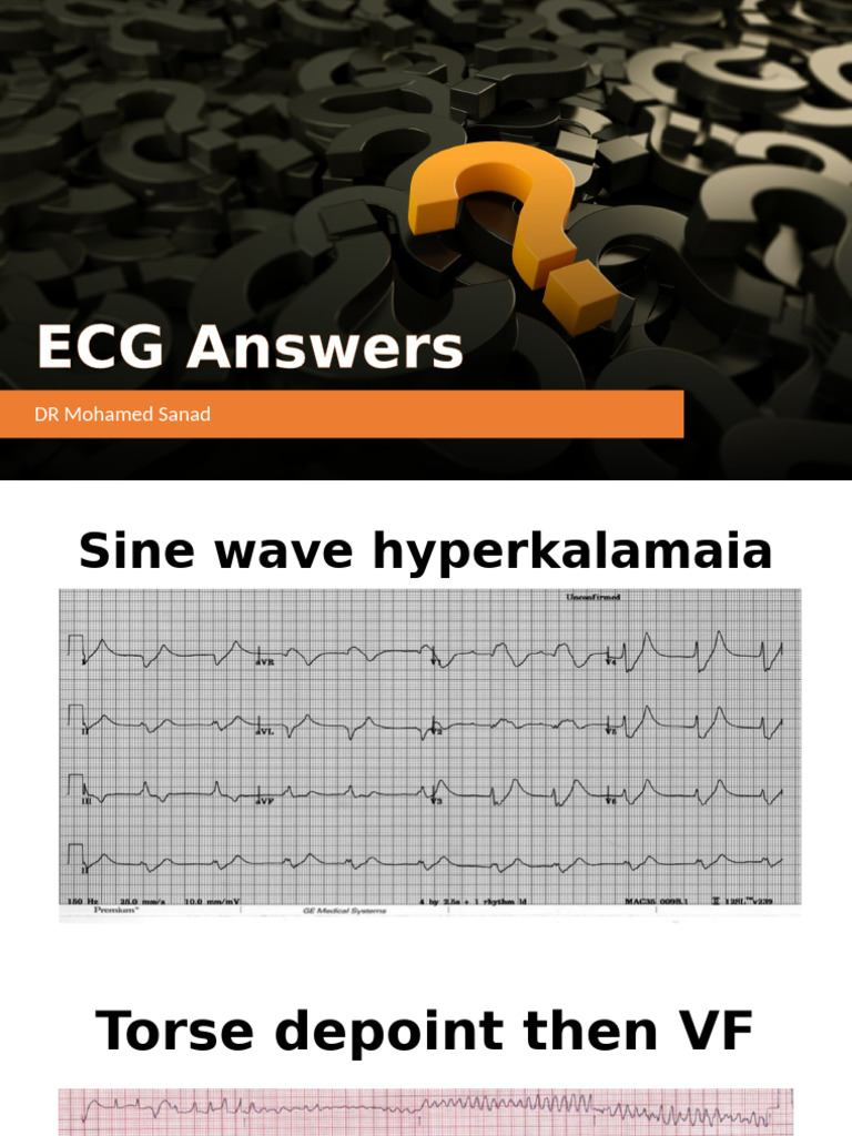 ecg answers | PDF