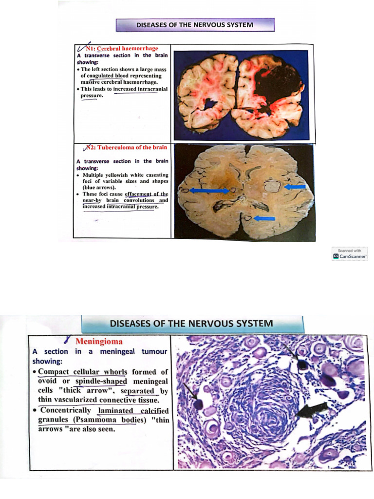 Practical Pathology CNS | PDF