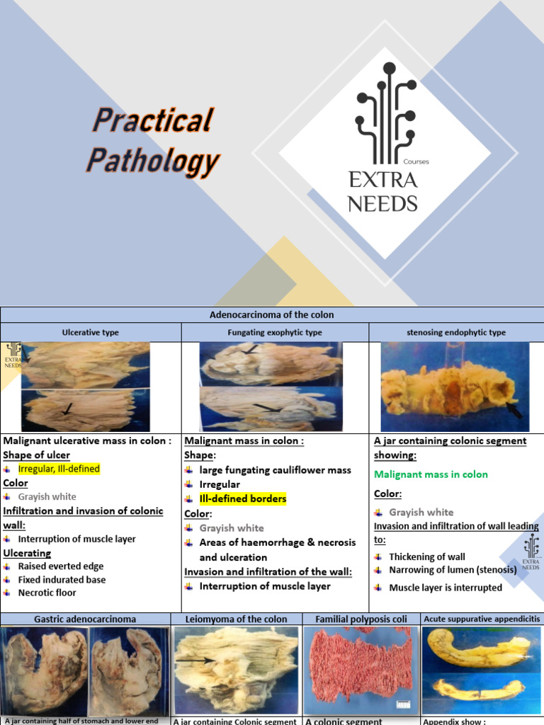 Pathological Findings in Colorectal Tumors | PDF | Liver ...