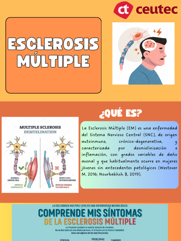 Esclerosis Múltiple | PDF