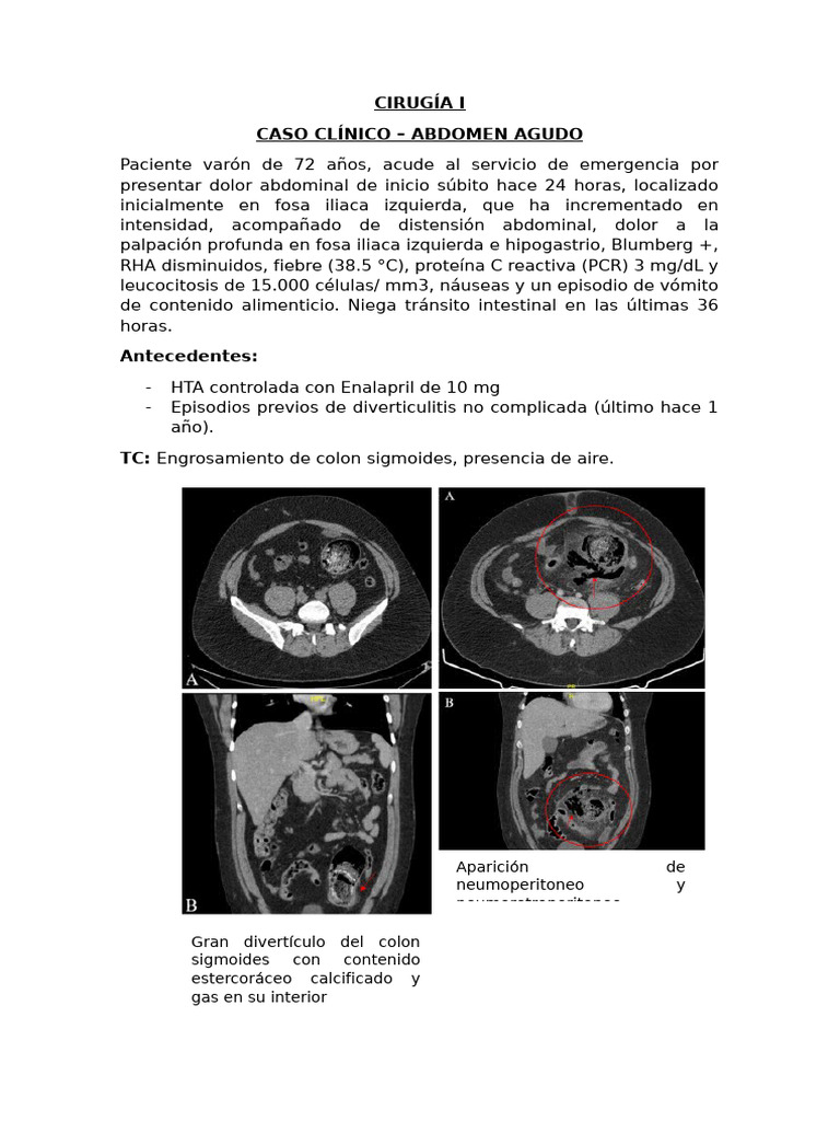 Caso Clínico CX 1 - Abdomen Agudo | PDF