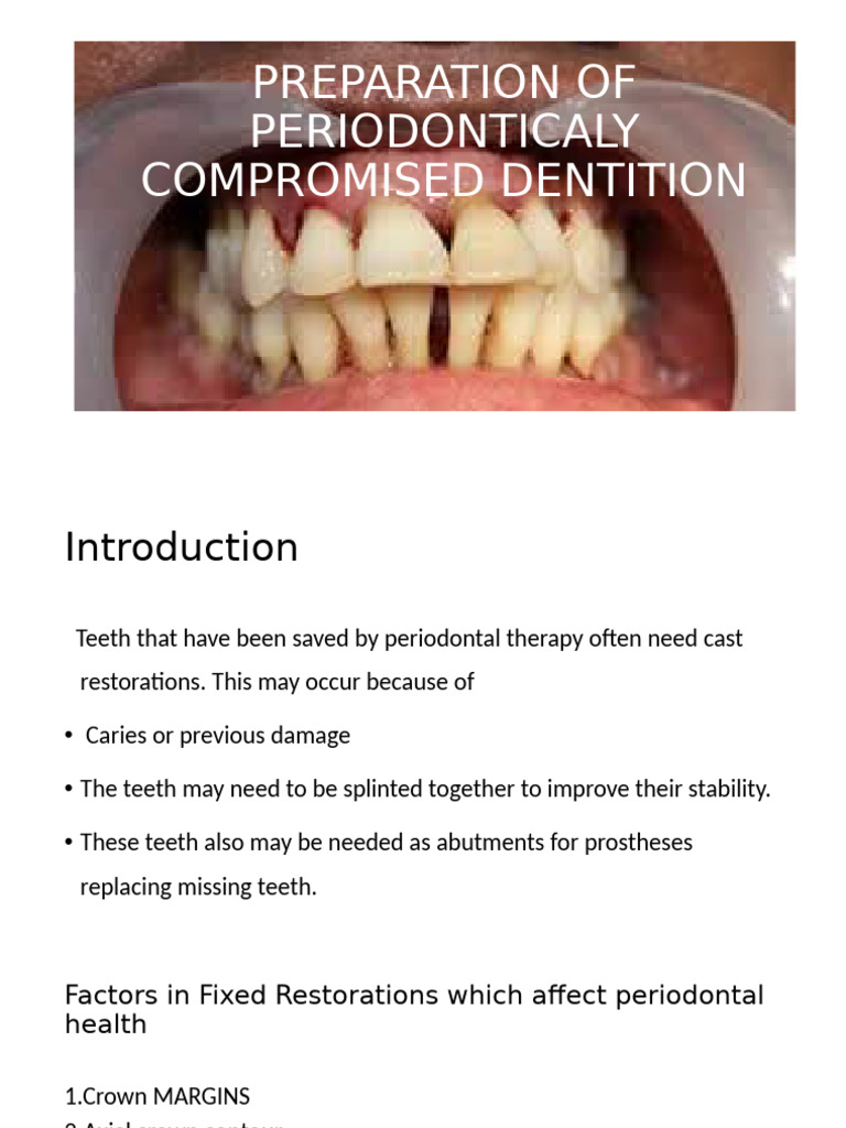 Treatment of Periodontically Compromised Teeth | PDF | Periodontology ...