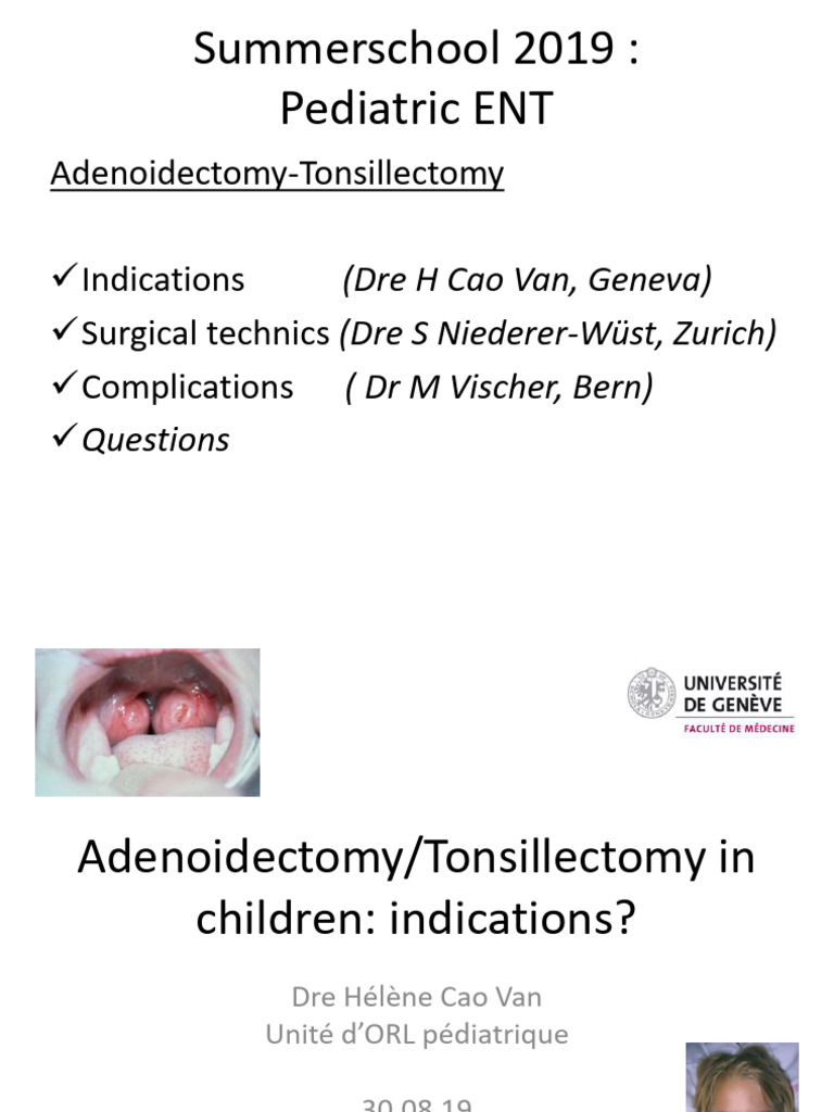Adenoidectomie Et Tonsillecto Mie Chez L Enfant Cao Van | PDF | Human Diseases And Disorders ...