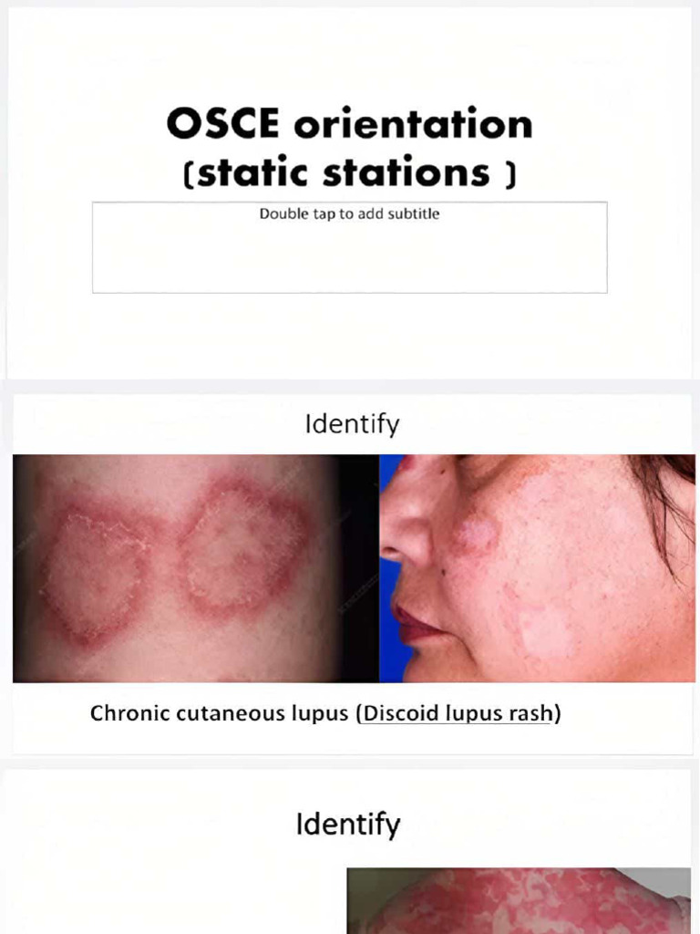 Static Stations - Rheumatology | PDF