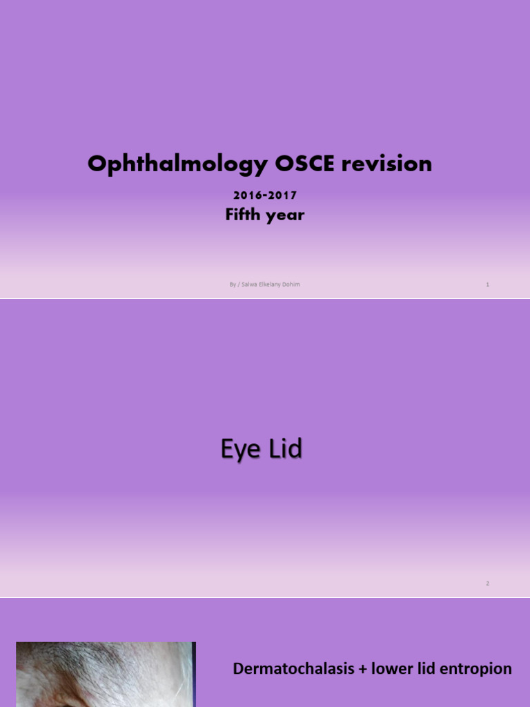 1 - Osce - PDF All in One Ophth | PDF | Cataract | Glaucoma