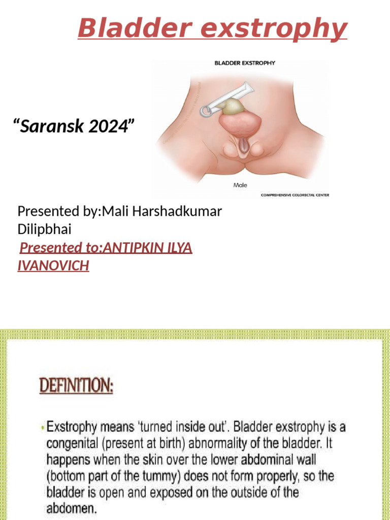 bladder exstrophy | PDF