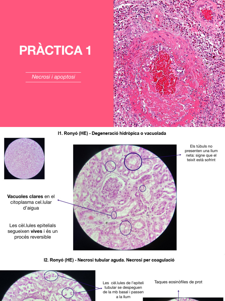 Apg Pràctiques Micros | PDF