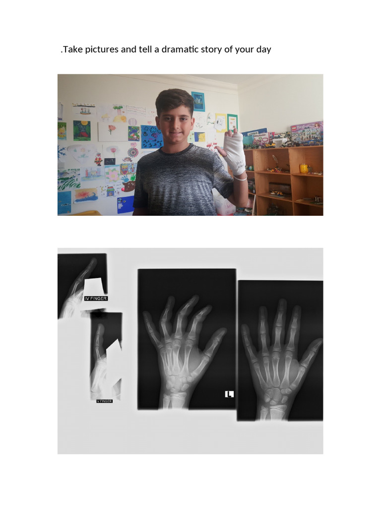 Take Pictures and Tell A Dramatic Story of Your Day | PDF
