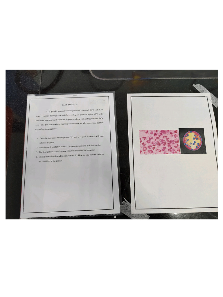 Micro Case 3 | PDF