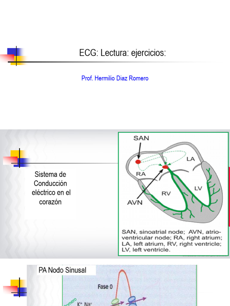 Ejercicio Ecg Medicina I Full Code | PDF
