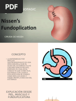 Fundoplicatura Toupet | PDF | Esófago | Gastroenterología