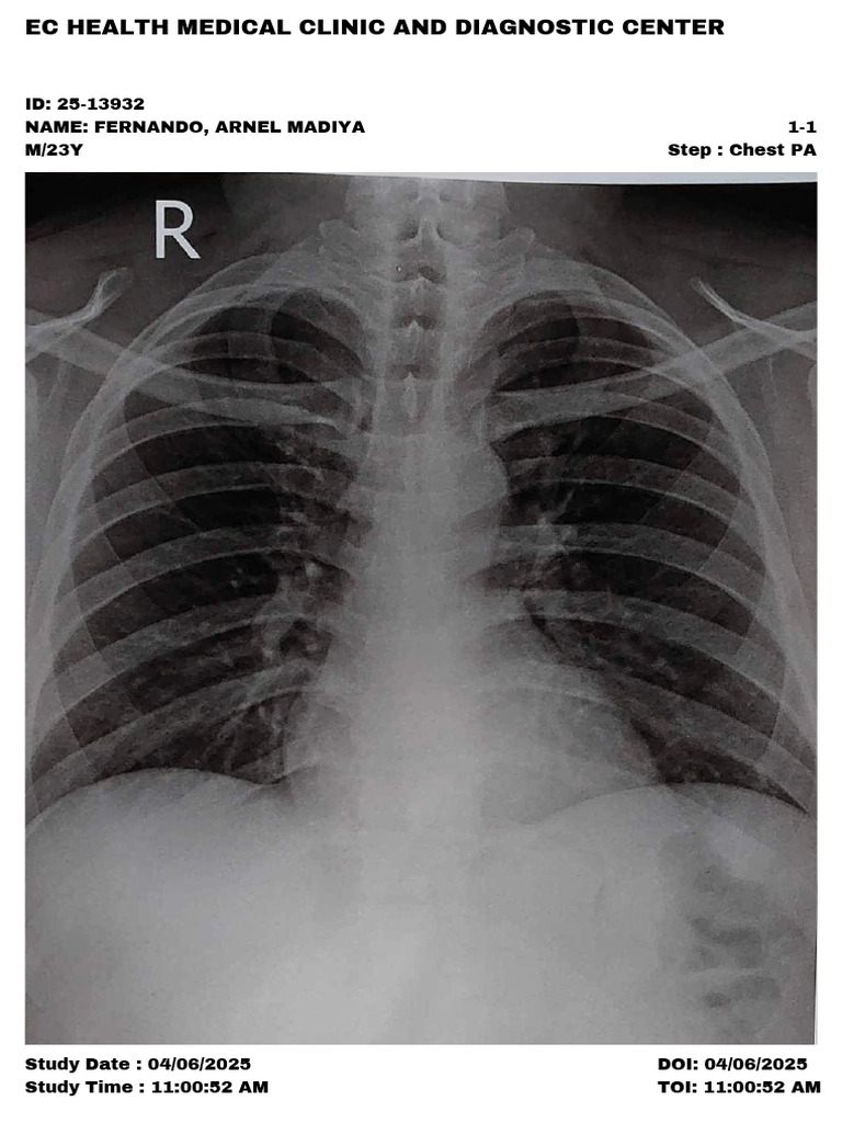 Xray Arnel - 20250408 - 184232 - 0000 | PDF