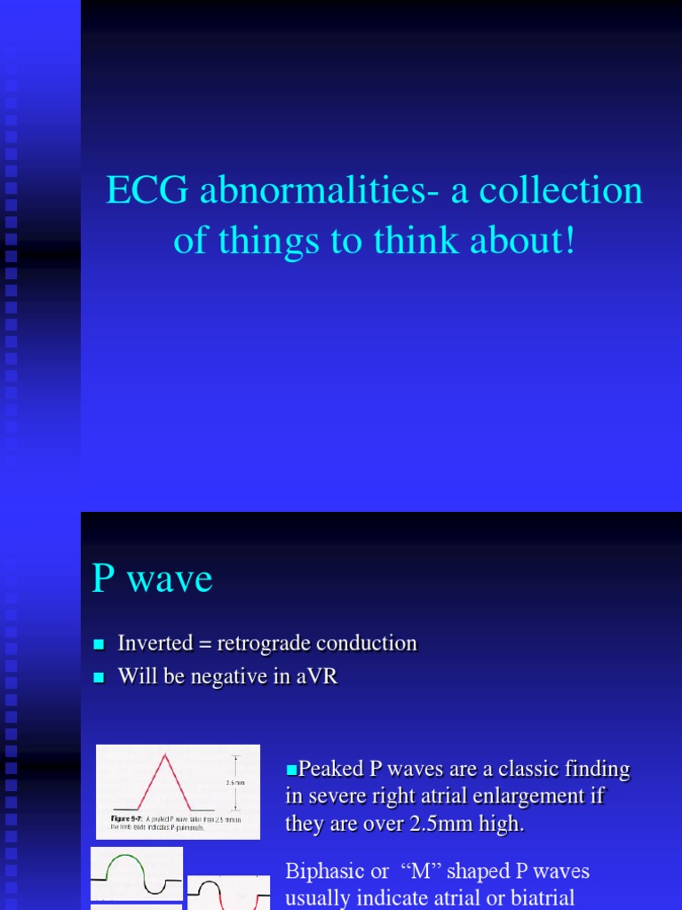 ECG Abnormalities - A Collection of Things To | PDF ...