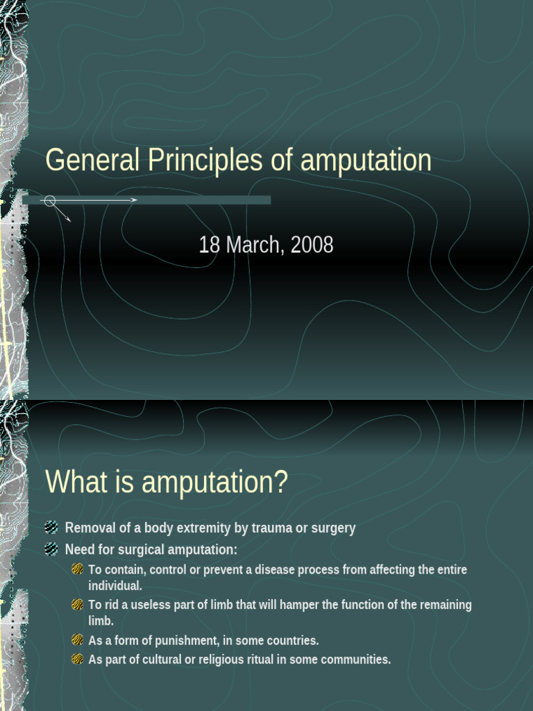 General Principles of Amputation | PDF | Amputation | Prosthesis