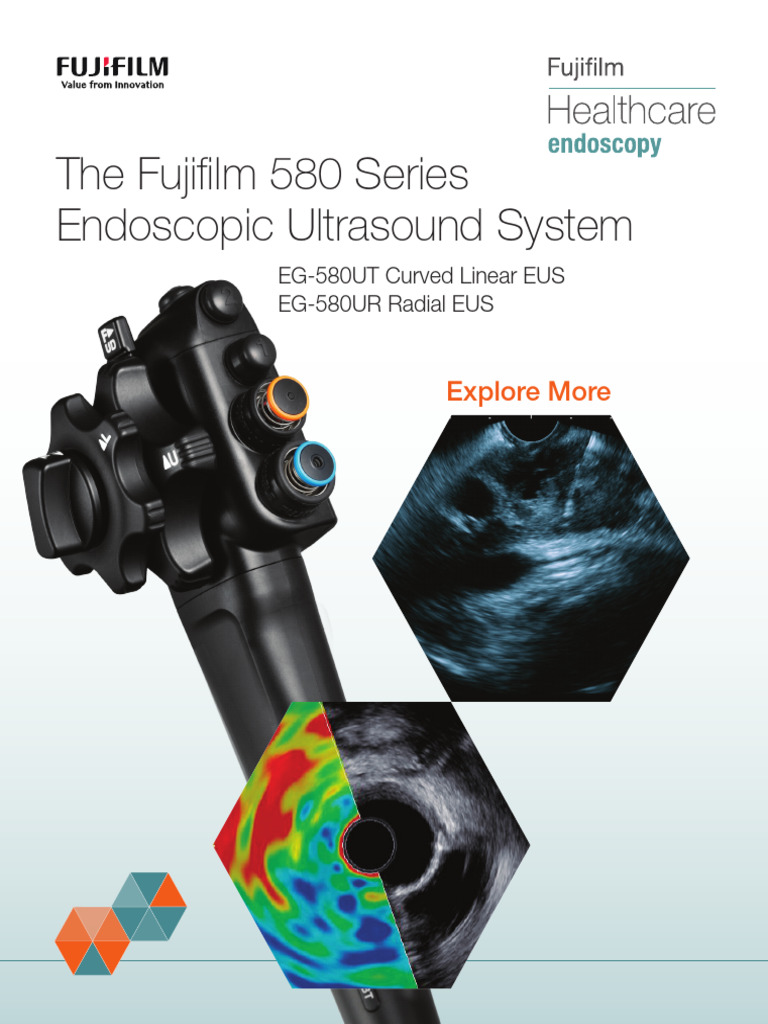 Fujifilm-EG-580UT-UR Brochure - EUS | PDF | Medical Ultrasound ...
