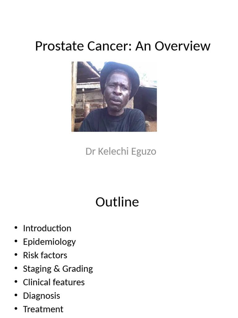 Prostate Cancer PPT Final | PDF | Prostate | Prostate Specific Antigen