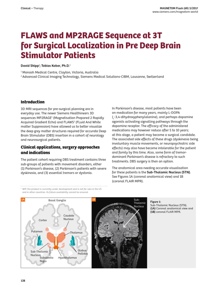 Surgical Localization in Pre DBS Patients | PDF | Deep Brain ...
