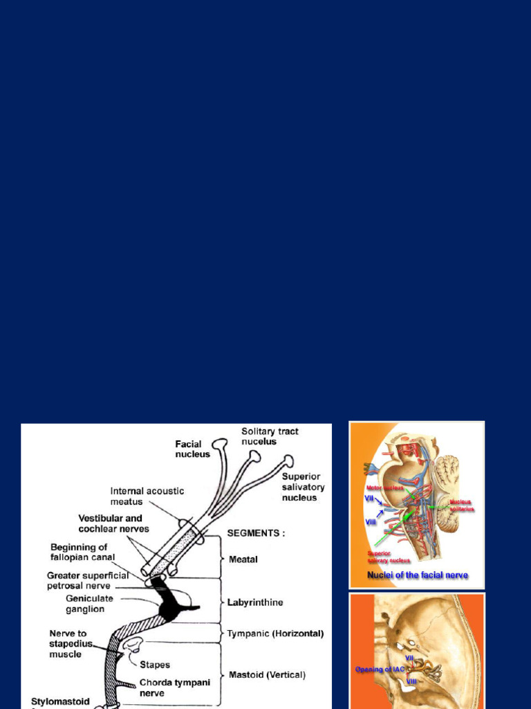 Facial Nerve Paralysis Overview | PDF | Human Head And Neck | Human Anatomy
