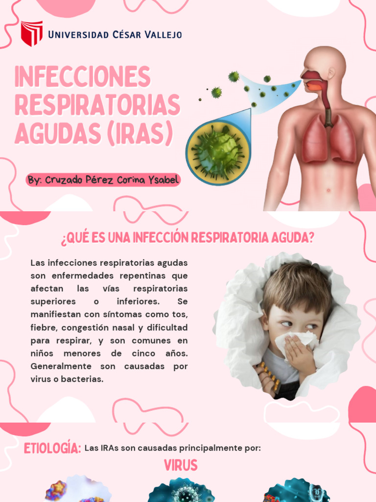 Infecciones Respiratorias Agudas (IRAS) | PDF | Influenza | Especialidades Medicas