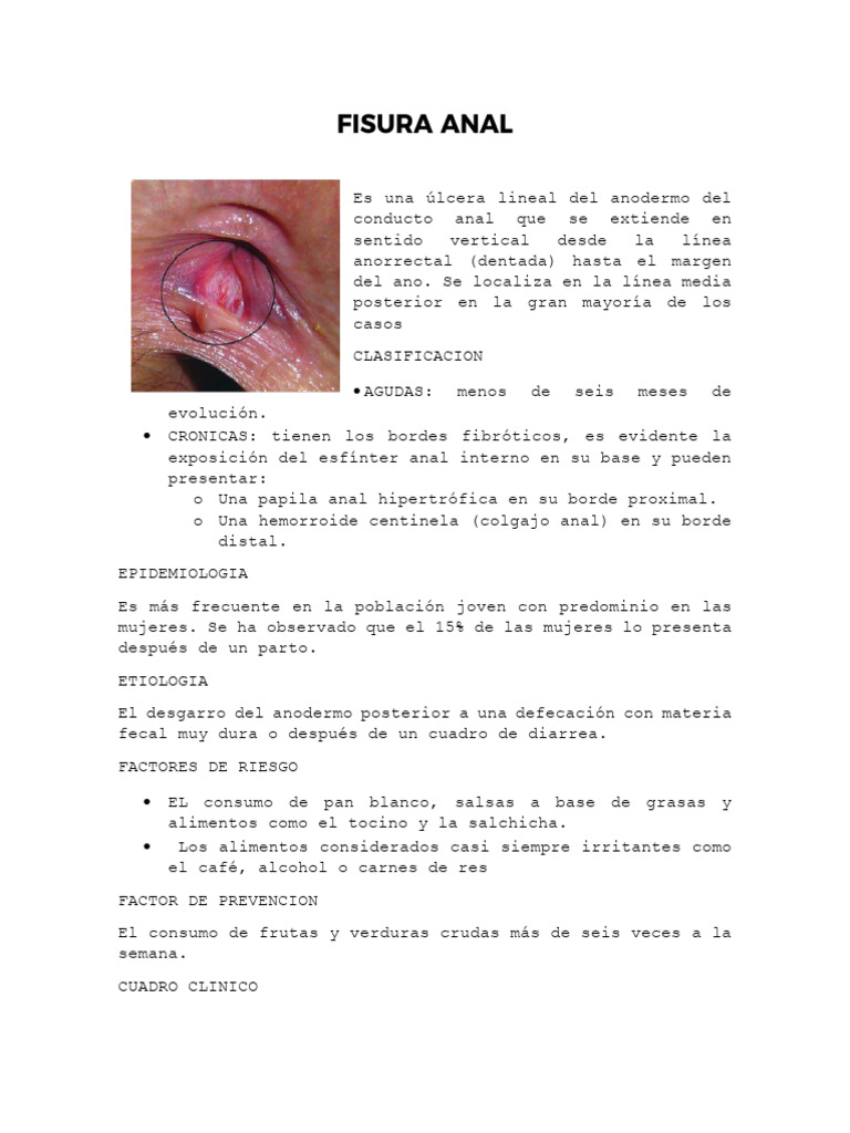 Fisura Anal Ciru | PDF | Heces | Hemorroides
