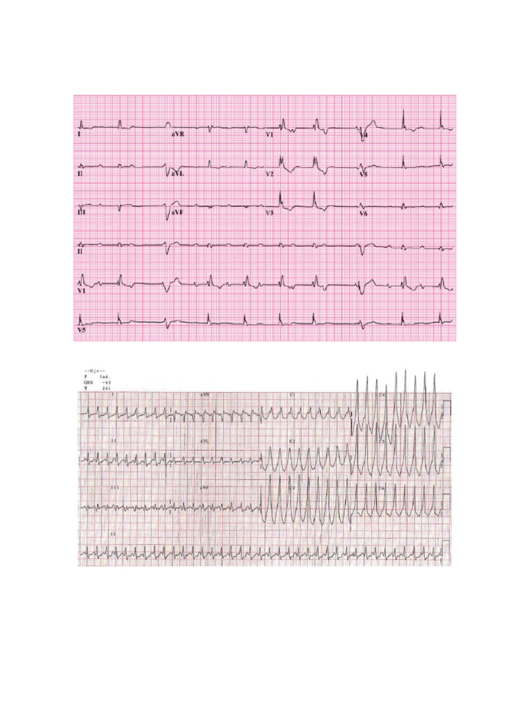 Taller Electros | PDF
