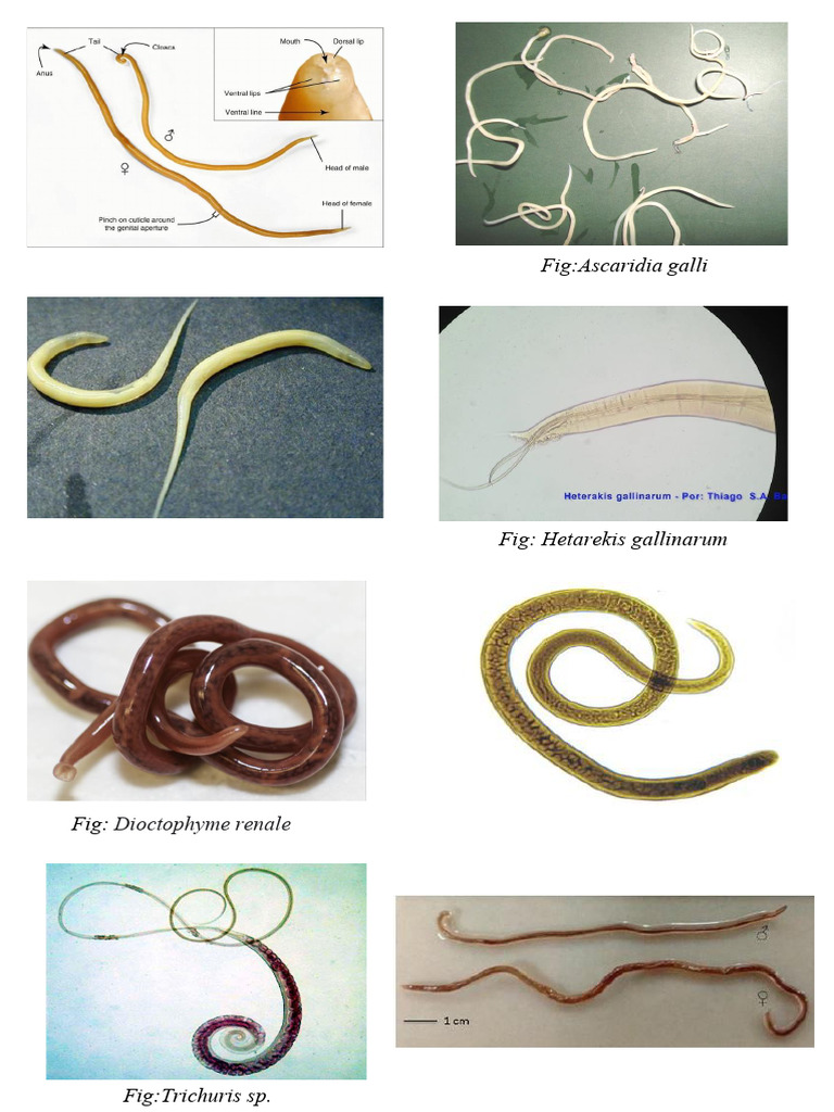 Fig:Ascaridia Galli Fig:Ascaris Suum: Dioctophyme Renale | PDF