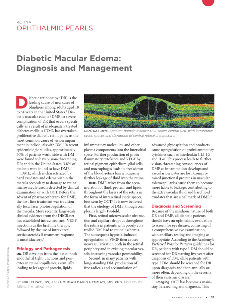 May 2021 Ophthalmic Pearls | PDF | Retina | Diseases And Disorders