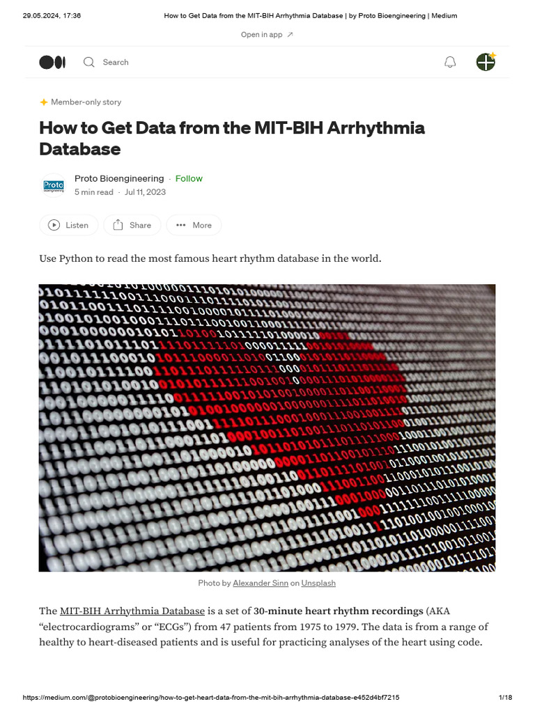 How To Get Data From The MIT-BIH Arrhythmia Database - by Proto ...