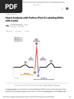 How To Get Data From The MIT-BIH Arrhythmia Database - by Proto ...