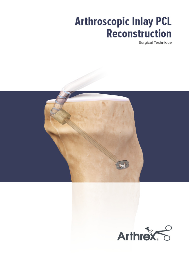 Arthroscopic Inlay PCL Reconstruction: Surgical Technique | PDF | Anatomical Terms Of Location ...
